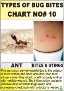 12 Most Harmful Types Of Bug Bites Chart Explained! | Y-L-P-C