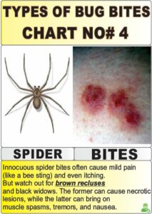 12 Most Harmful Types Of Bug Bites Chart Explained! | Y-L-P-C